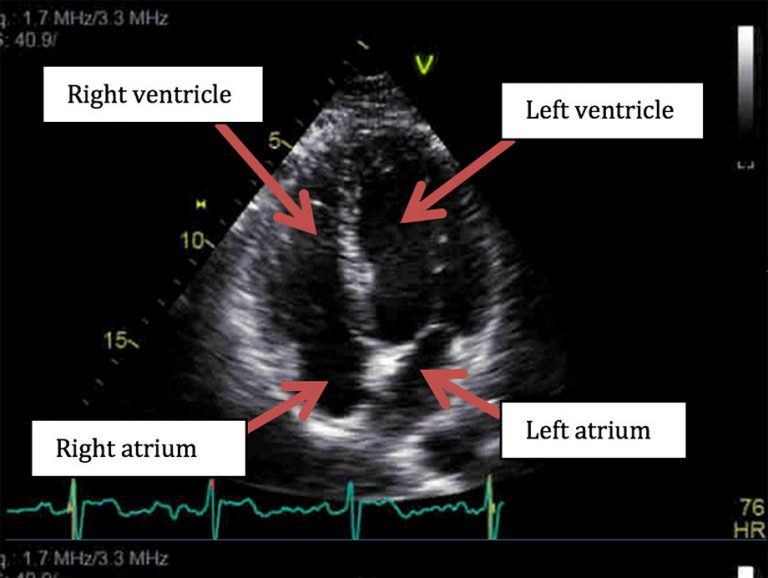 Cardiac Imaging: Looking Inside the Heart - Mount Sinai Medical Center