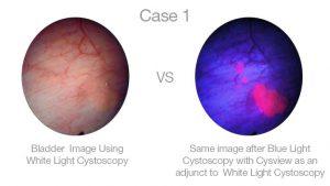 Urinary Track Conditions & Treatments for Men