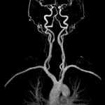 Diagnostic Imaging Services - Mount Sinai Medical Center